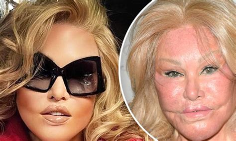 The Enigmatic Life Of Jocelyn Wildenstein From Fame To Financial