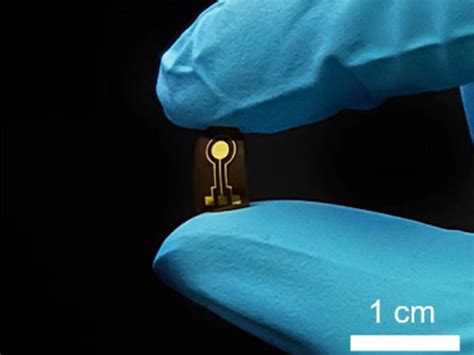 Novel Implantable Sensor Sniffs Out Possible Signals Of Osteoarthritis Trendradars
