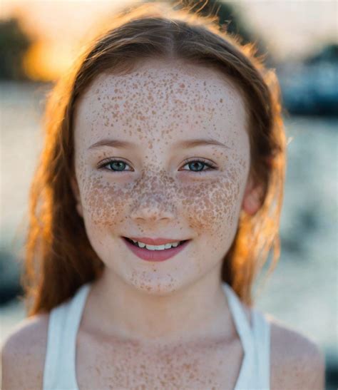 Freckles Women With Freckles Freckles Girl Freckles