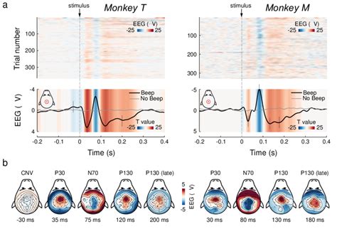 Stimulus Induced Eeg Modulations A Top Single Trial Modulations At Download Scientific