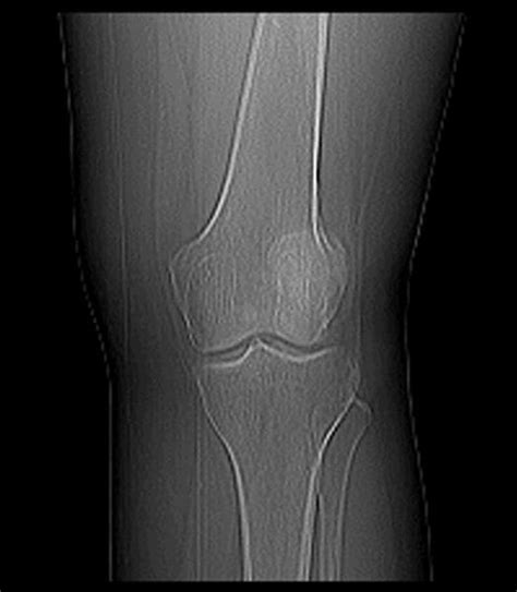 Joint CT Insight Medical Imaging