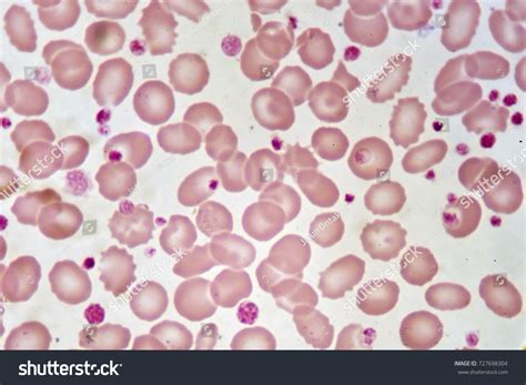 Platelets Microscope