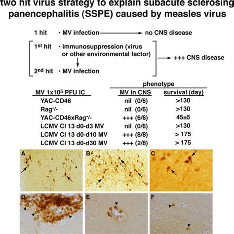 persistent mv infection in the transgene mice the sspe tg mouse model