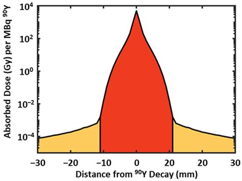Single Compartment Dose Prescriptions For Ablative 90y Radioembolization Segmentectomy
