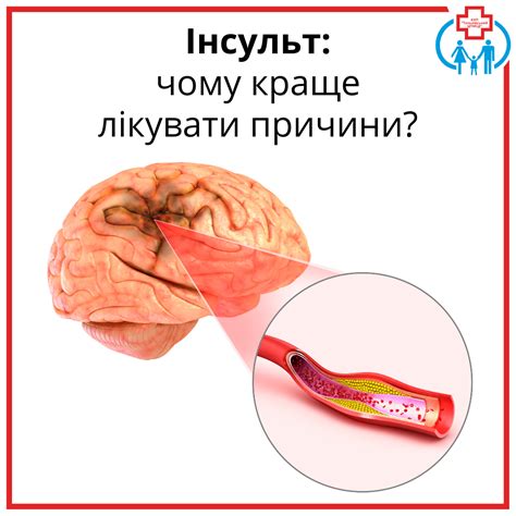 КНП «Тальнівський центр ПМСД Після інсульту у пацієнта можуть залишитися деякі проблеми 👌