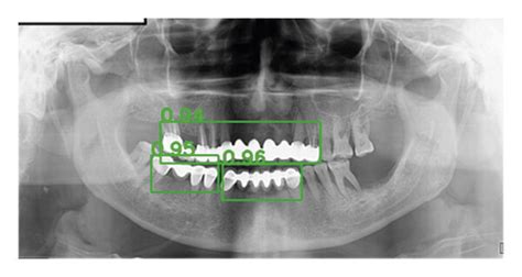 A Confidence Scores For Bridge Detection Using Yolov4 B Original