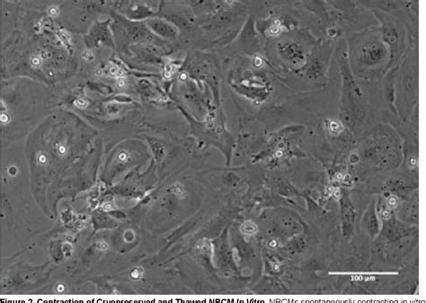 Figure 2 From Isolation And Cryopreservation Of Neonatal Rat Cardiomyocytes Semantic Scholar