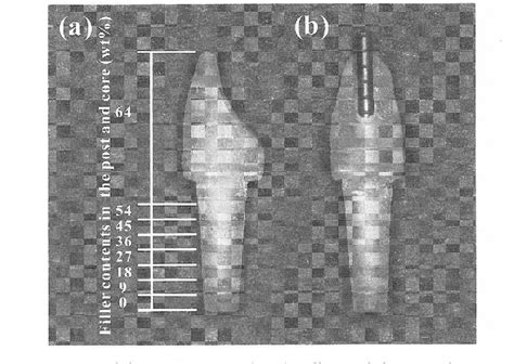 Figure 1 From Fabrication Of A Functionally Graded Dental Composite Resin Post And Core By Laser