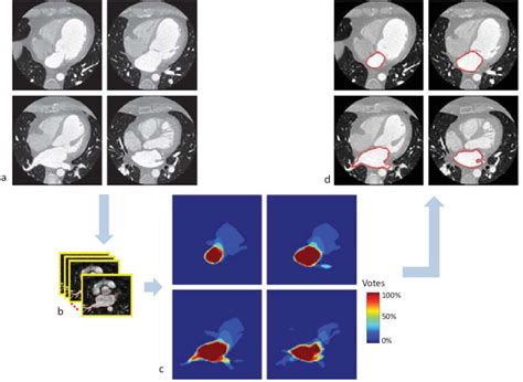 Diagram Of Multi Atlas Registration A Original Cta Image To Be Download Scientific Diagram