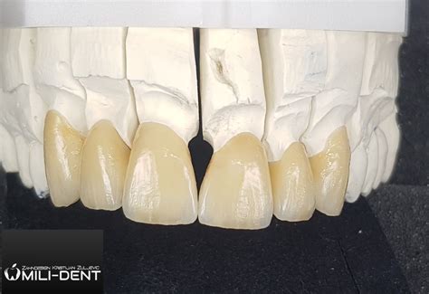 Pin by Patrycja Górniak on Technik dentystyczny | Dental
