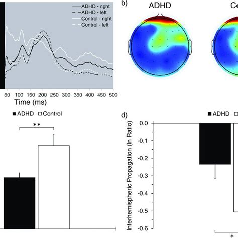 Tms Induced Activation Following The Delivery Of A Single Pulse To The Download Scientific
