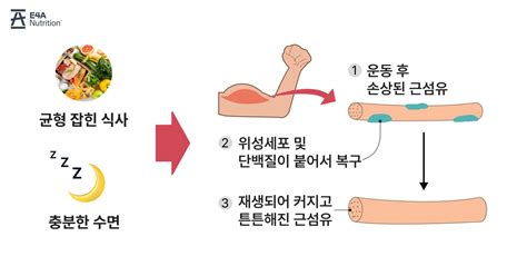 운동직후 보다 이틀 뒤가 더 아픈 이유 지연성 근육통 Doms E4a 매거진