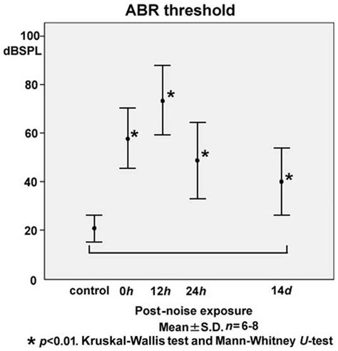 Time Course Of Shifts In The Auditory Brainstem Response Abr Download Scientific Diagram
