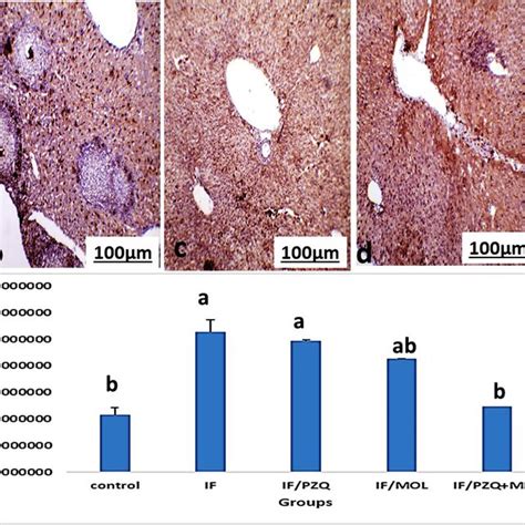 Representative Immunohistochemical Staining For Nuclear Factor Kappa β