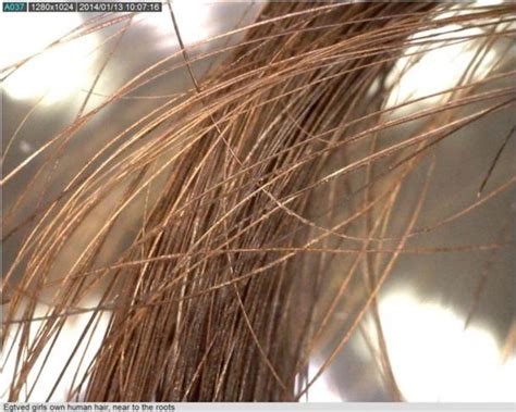 The Surprising And Iconic Bronze Age Egtved Girl Teenage Remains Tell