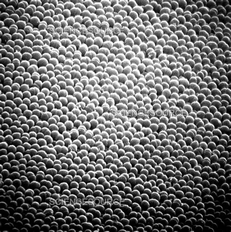 Photograph Streptococcus Pyogenes Science Source Images