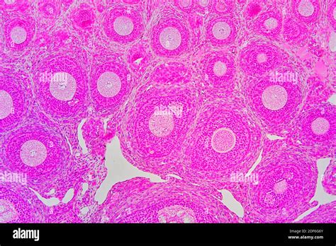 Ovary Slide Labeled Ovum