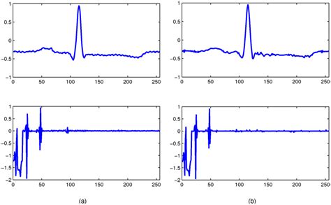 an original segment of record no 100 in the mit bih arrhythmia database download scientific
