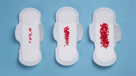 Top 999 Implantation Bleeding Images Amazing Collection Implantation Bleeding Images Full 4k