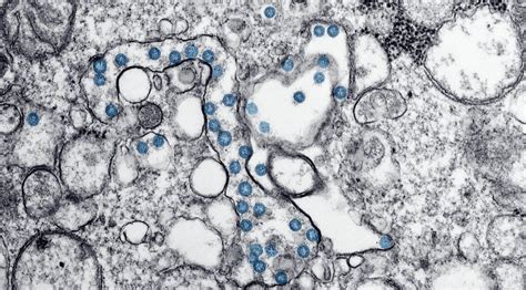 Eye Health And The Microbiome