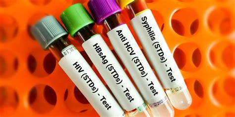 6 Signs You May Have A Sexually Transmitted Disease Std Imperial