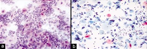 Cervical Cytology Emodule On Cervical Cytology