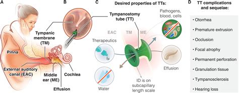 Design Of Medical Tympanostomy Conduits With Selective Fluid Transport