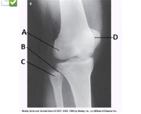 Ap Oblique Medial Rotation X Ray Anatomy Diagram Quizlet
