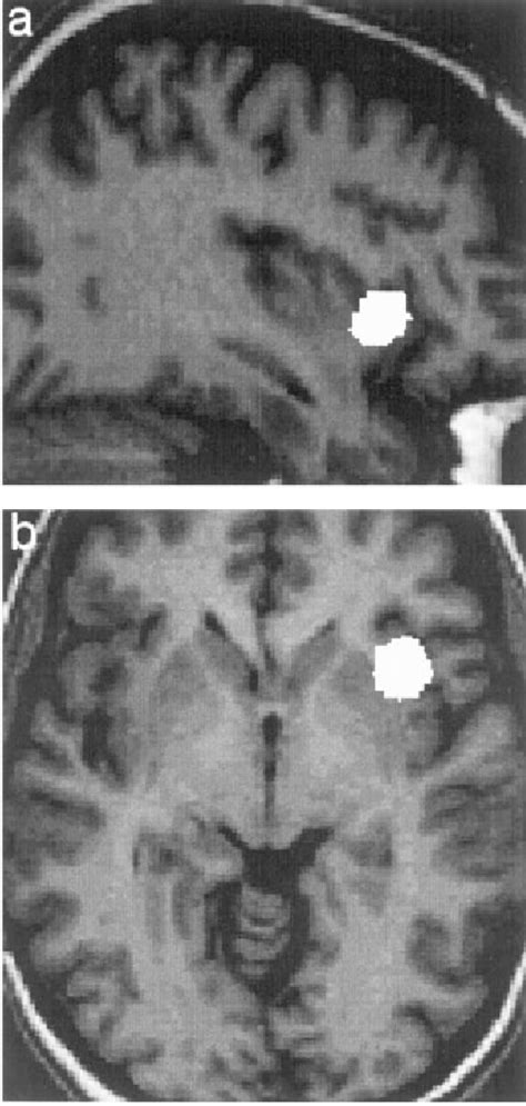 Figure 3 From Neural Correlates Of Auditoryvisual Stimulus Onset Asynchrony Detection