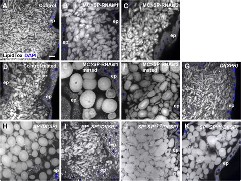 Drosophila Sex Peptide Controls The Assembly Of Lipid Microcarriers In Seminal Fluid Pmc