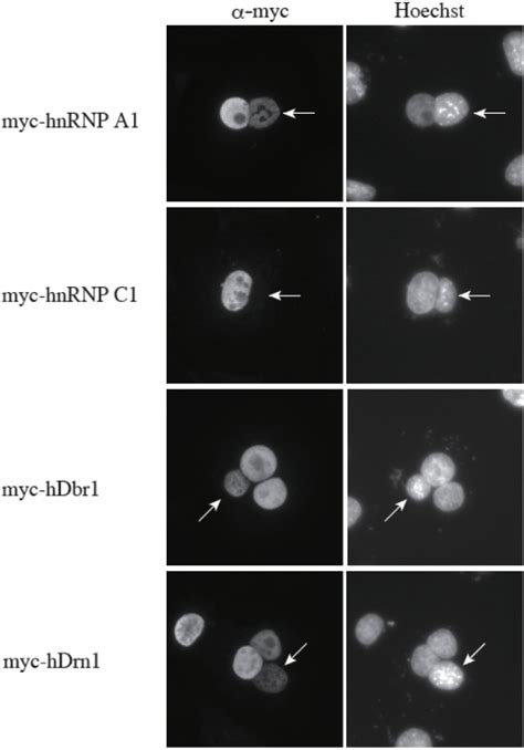 Figure 7 From Identification Of The Specific Interactors Of The Human Lariat Rna Debranching