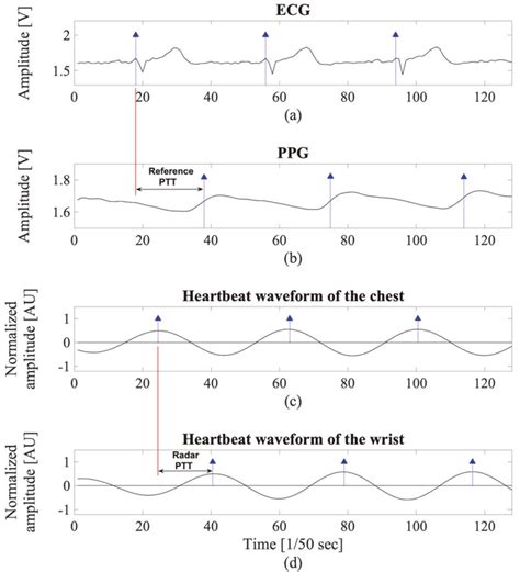 Waveforms Of Ecg Ppg And Heartbeat Waveform Of The Chest And The Download Scientific Diagram