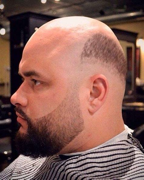Male Pattern Baldness Bald Fade Bald With Beard