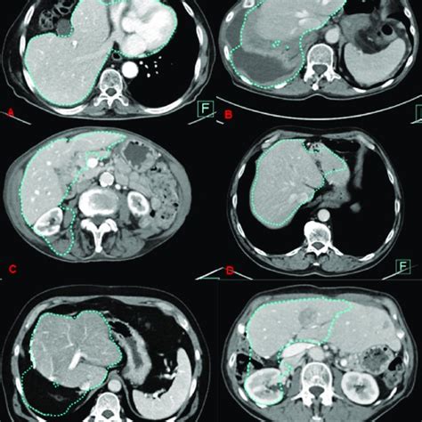 Flowchart And Components Of The Liver Segmentation System Download Scientific Diagram