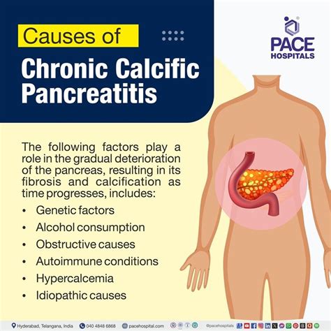 Chronic Calcific Pancreatitis Causes Complications And Treatment