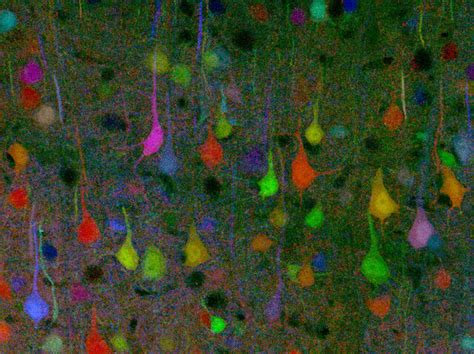 Somewhere Over The Brainbow The Journey To Map The Human Brain Npr