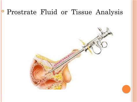 Diagnostic Evaluation Of Male Reproductive System Ppt