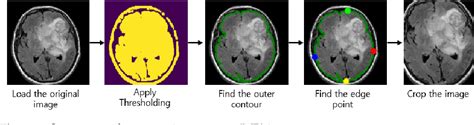 Figure 2 From Mri Based Brain Tumor Classification Using Ensemble Of Deep Features And Machine