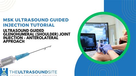 Ultrasound Guided Injection
