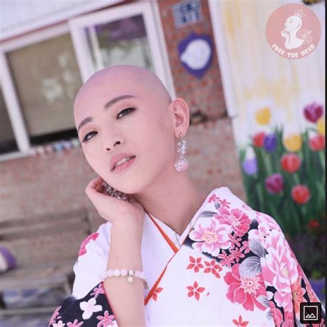 Bald Asian Woman Bald Hair Asian Woman Women