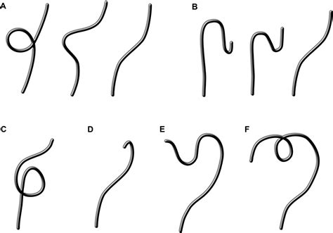 Diagnostic Ileocolonoscopy Getting The Basics Right Frontline Gastroenterology