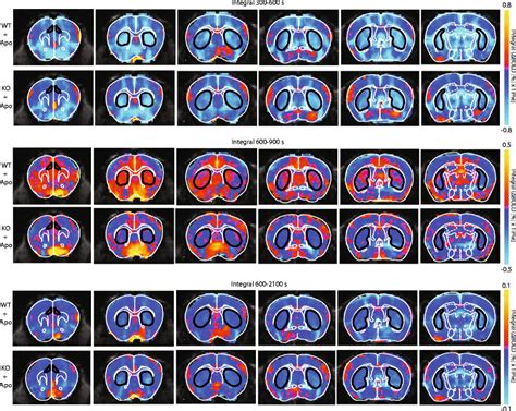 Color Coded Maps To Visualize Voxel Wise Integral Of The Bold Signal