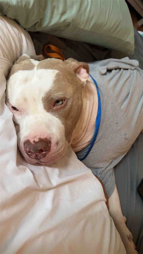 Fundraiser By Natalie Bruno Emergency Amputation Anything Helps