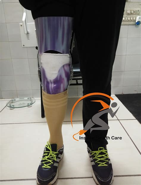 Inspire Structure Lower Extremity Prosthesis