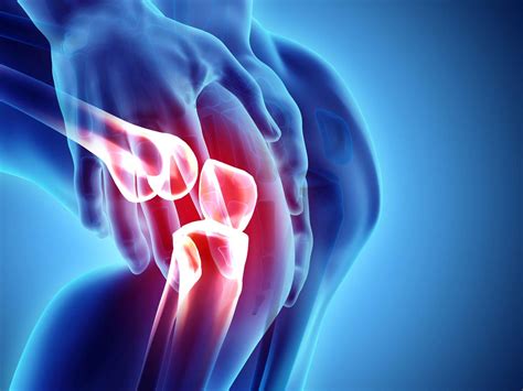Can Sciatica Cause Knee Pain Causes And Treatment