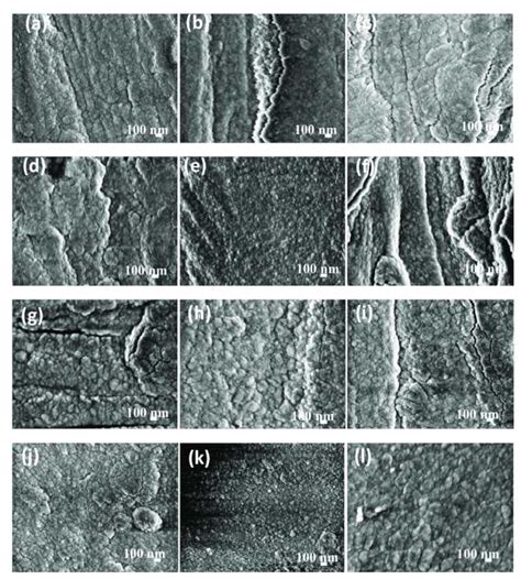 Transmission Electron Microscope Vs Scanning Electron Microscope A Level At Thomas Shea Blog