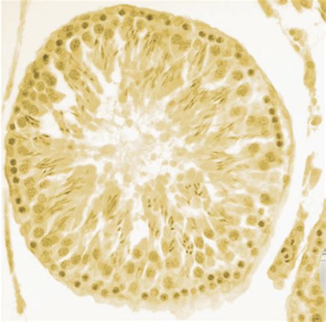 Final Lab Exam Flashcards Quizlet