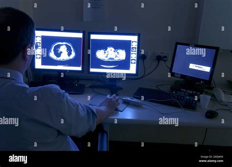 CT Scans Technician Viewing Computed Tomography CT Scans On Computer Screens CT Is A