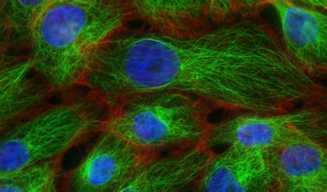 Туморните маркери в диагностиката на рака Vivata Bg