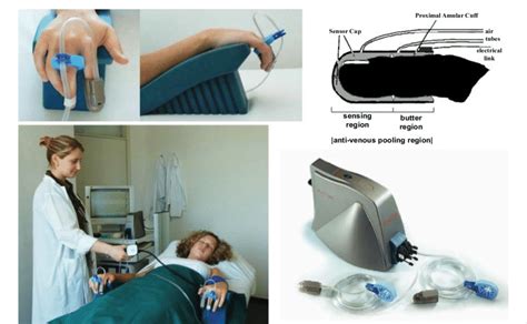 Endothelial Function Measured By Endopat ® Download Scientific Diagram